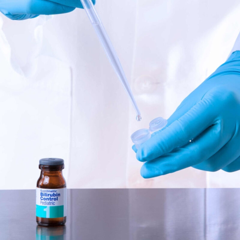 Bilirubin Control Pediatric | Quantimetrix