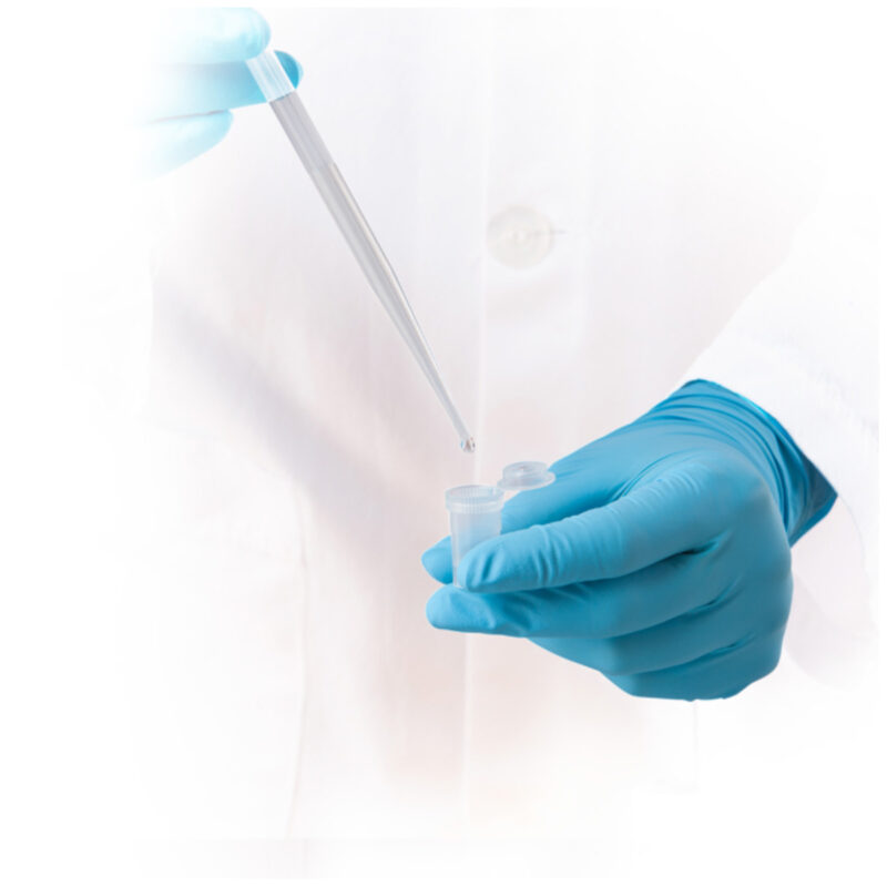 QUANTTEST RED - Pyrogallol Red Total Protein Reagent